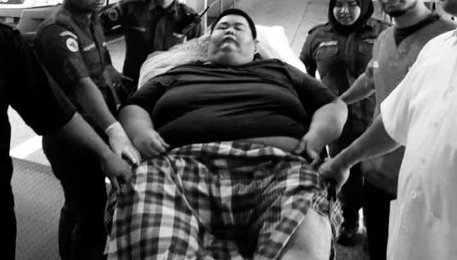 Ultra obese youth dies of breathing complications | Free Malaysia Today ...